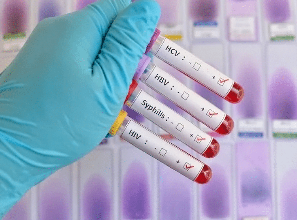 STD and STI Testing in Florida Harm Reduction